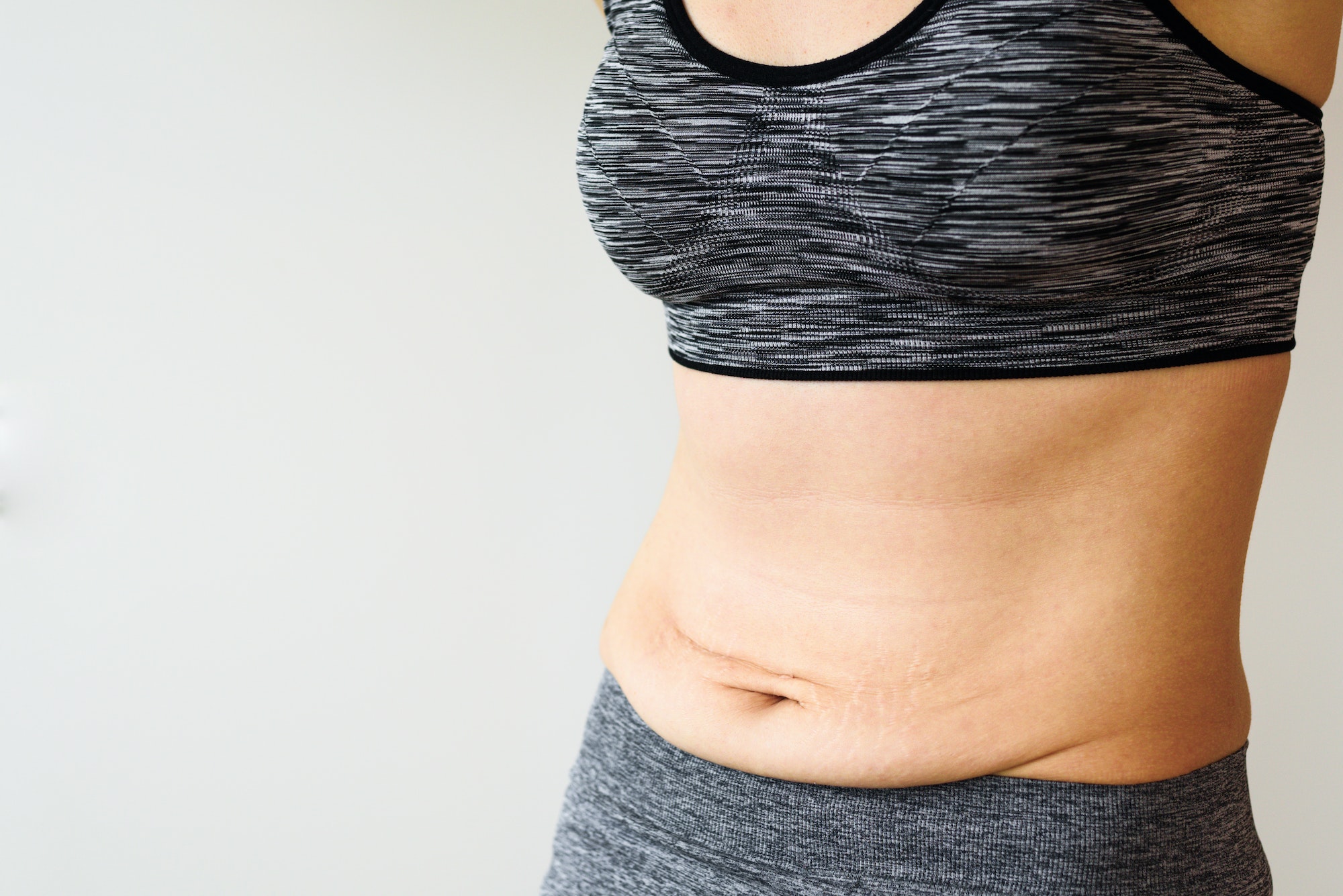 Skinny Fat Frauen